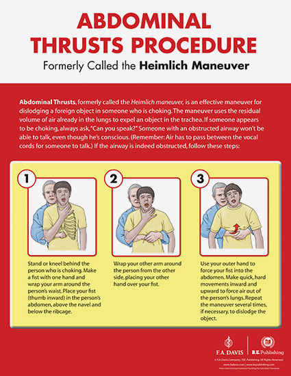 Abdominal Thrusts Procedure